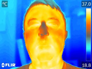 Detecting elevated body temperatures is often our first line of defense